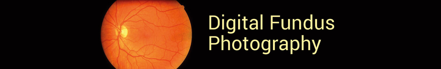 Fundus Photography | Specsure Opticians Consett